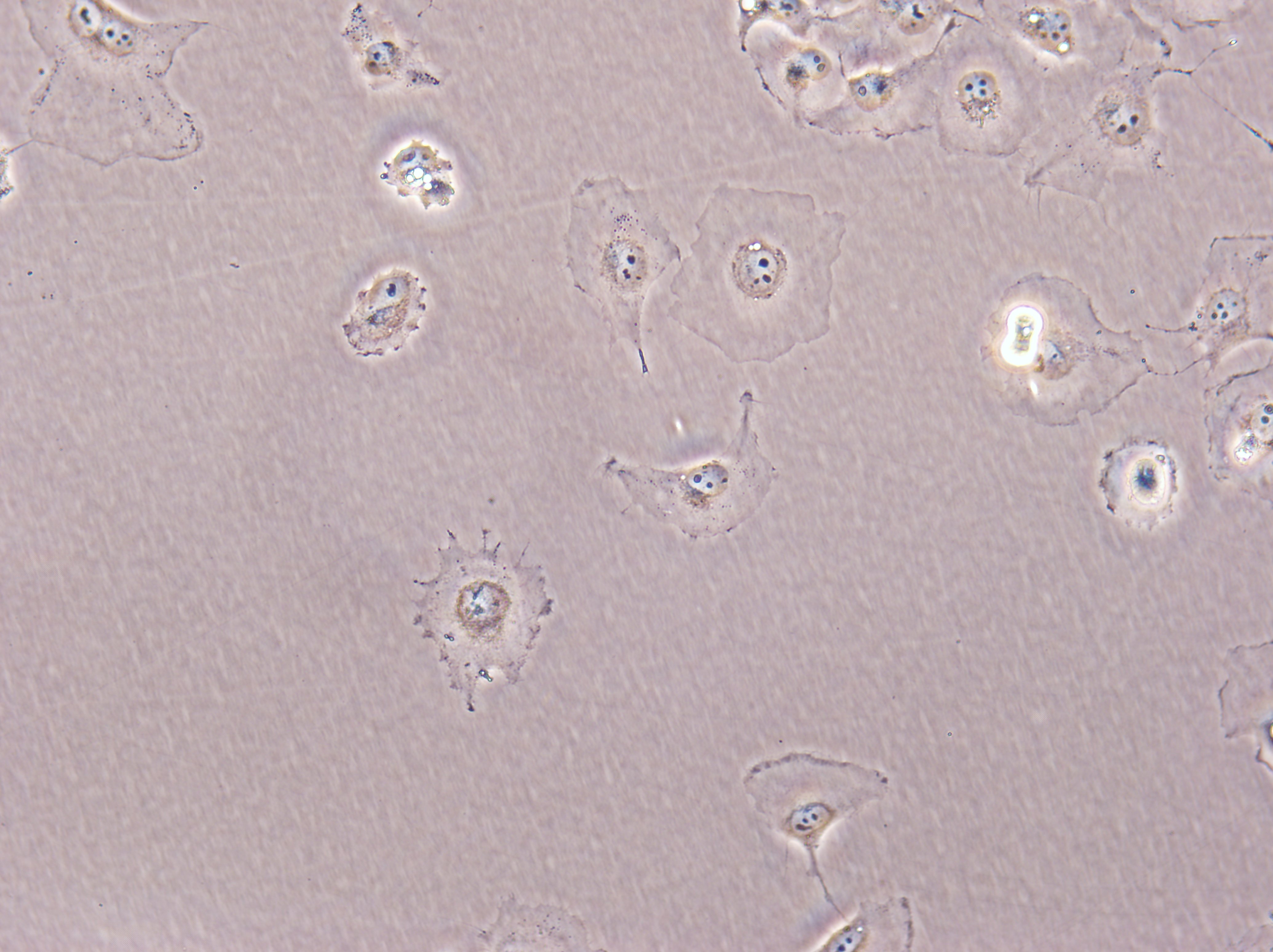 SIGNAL AND IMAGE PROCESSING GROUP AT BILKENT UNIVERSITY